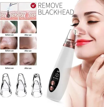 Blackhead Remover Instrument Black Dot Remover Acne Vacuum Suction Face ...